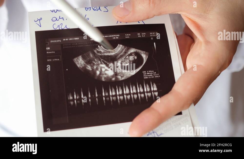 Foetus womb embryo Stock Videos & Footage - HD and 4K Video Clips - Alamy