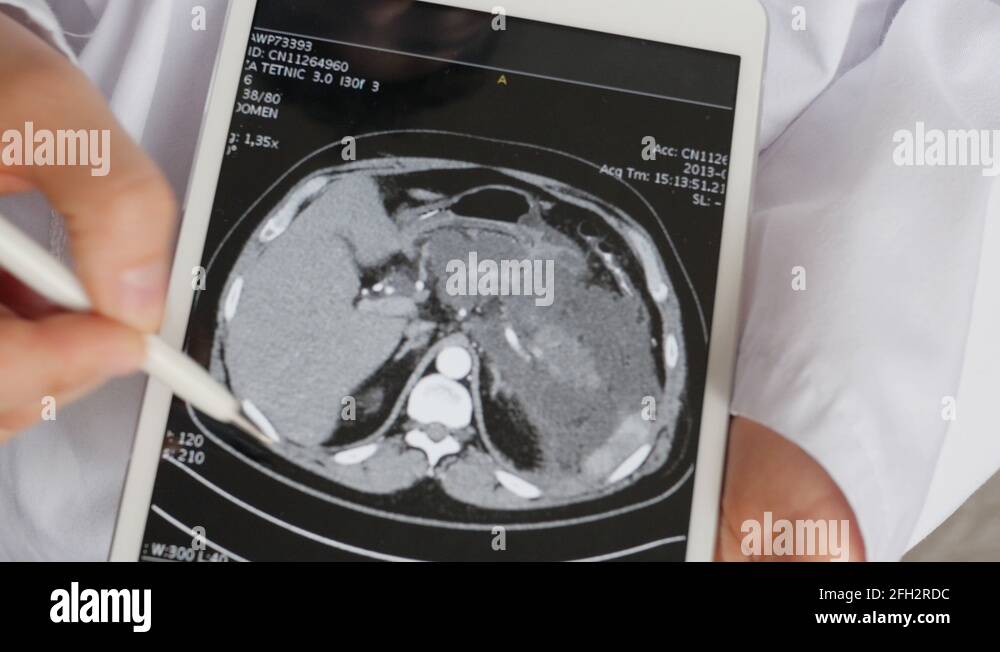 Computed tomography doctor Stock Videos & Footage - HD and 4K Video ...