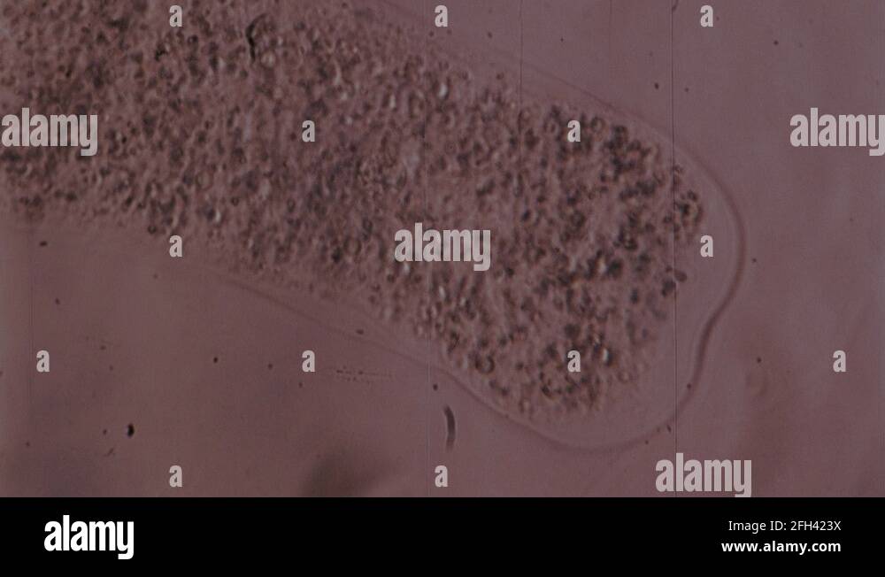 Amoeba Microscopic Microscope Cell Microorganism Biology Vintage 16mm ...