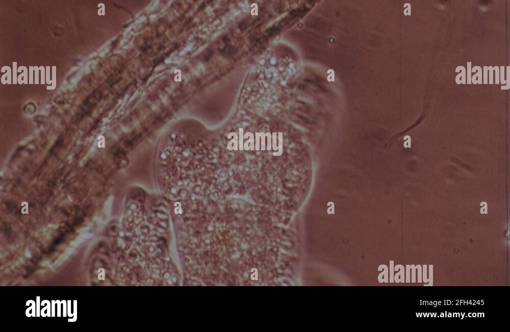 Amoeba Microscopic Microscope Cell Microorganism Biology Vintage 16mm ...