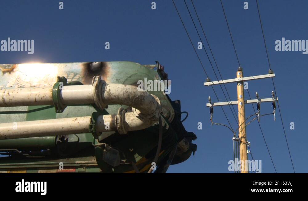 Electrical burn injury Stock Videos & Footage - HD and 4K Video Clips ...