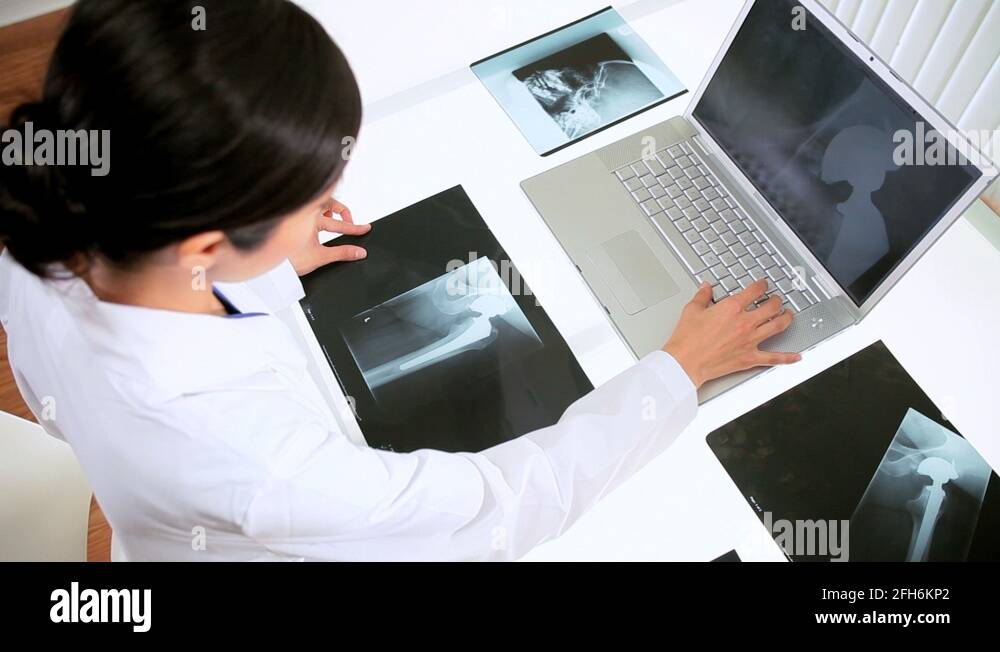 Anatomy x ray Stock Videos & Footage - HD and 4K Video Clips - Alamy