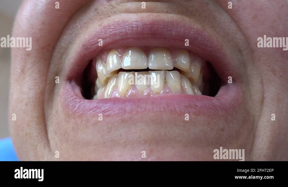 Forty years old Stock Videos & Footage - HD and 4K Video Clips - Alamy