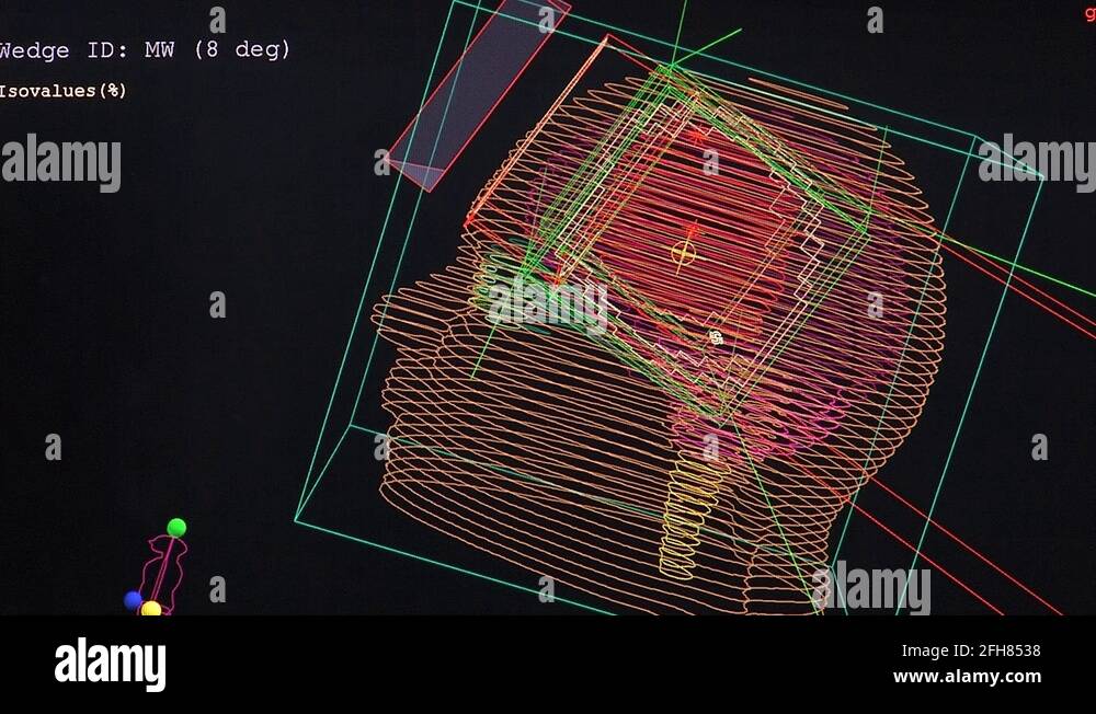 Eeg brain screen Stock Videos & Footage - HD and 4K Video Clips - Alamy