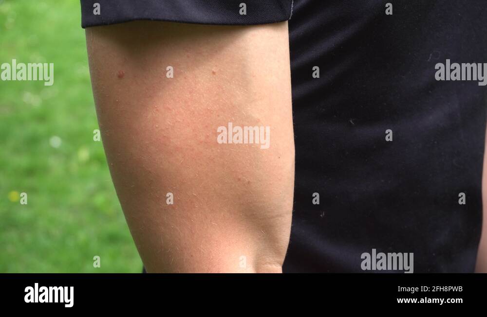 Contracting arm muscles Stock Videos & Footage - HD and 4K Video Clips ...