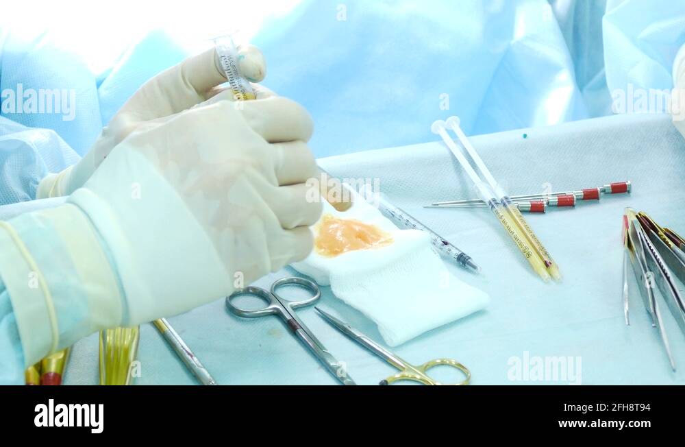 Fat injection Stock Videos & Footage - HD and 4K Video Clips - Alamy