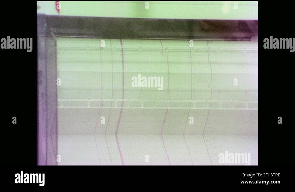 1970s: Lab machine reads graph on paper. Knobs and holes on lab ...