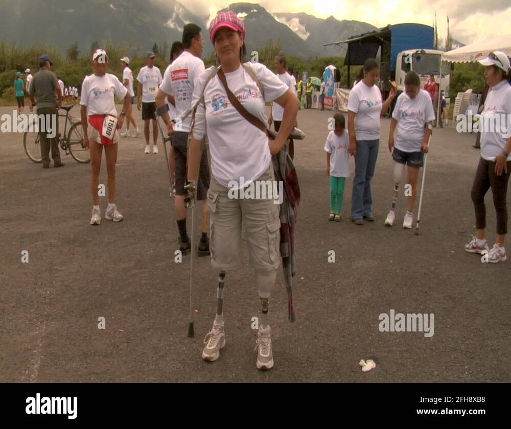 A woman with two prosthetic legs and a prosthetic arm smiles at a race ...