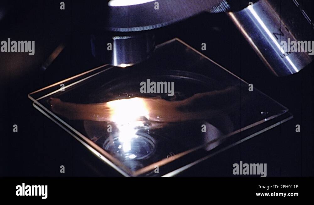 1970s Parasite Tapeworm Examine Under Microscope Vintage Film ...