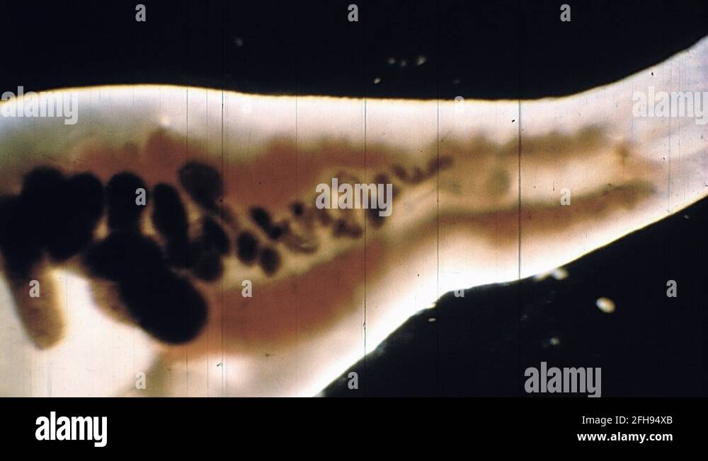 1970s Worm Parasite Tapeworm Under Microscope Vintage Old Film ...
