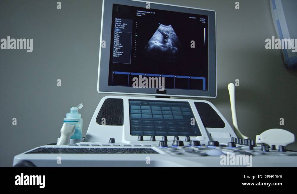 Ultrasound machine Stock Videos & Footage - HD and 4K Video Clips - Alamy
