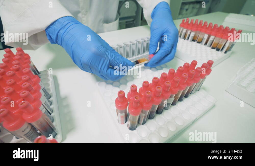 Laboratory worker looks at tubes, checking their condition at a ...