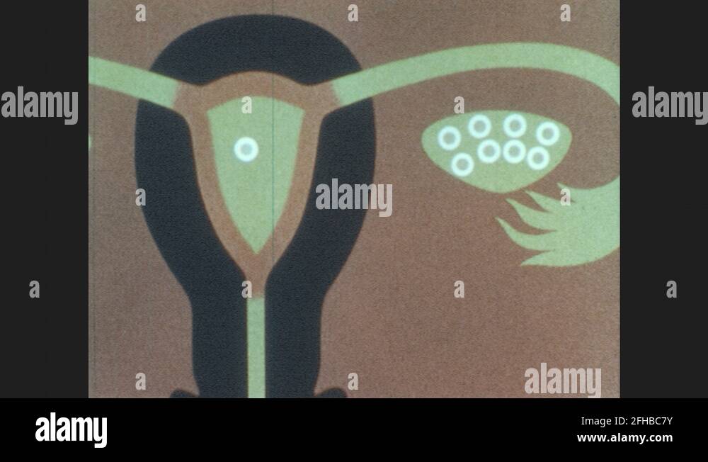 1960s: Drawing of female reproductive system, fertilized egg attaches ...