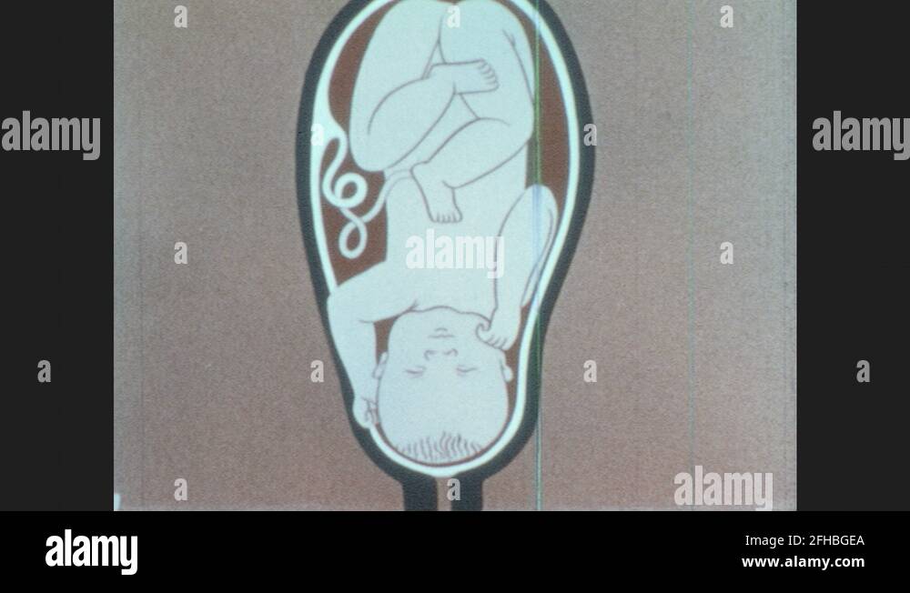 Large uterus Stock Videos & Footage - HD and 4K Video Clips - Alamy