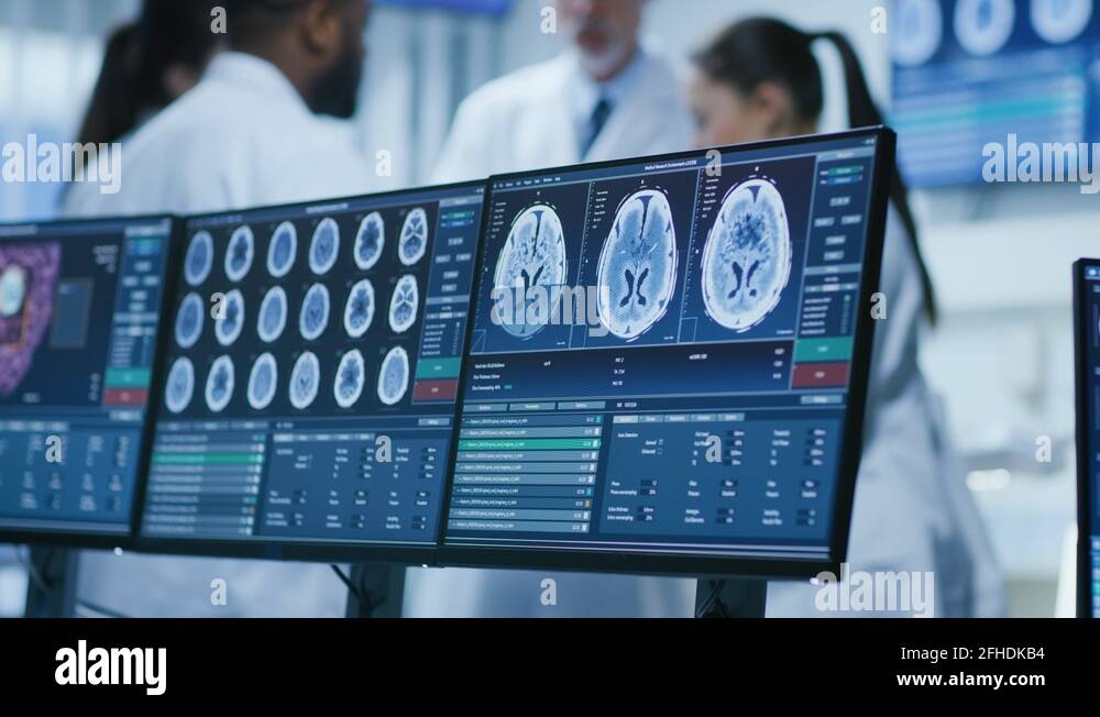 Computer Screen Showing MRI, CT Image Scan of the Brain Stock Video ...