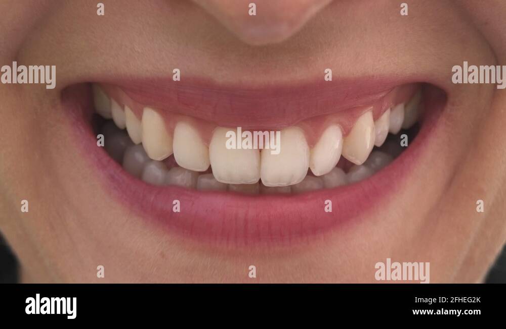 White teeth Stock Videos & Footage - HD and 4K Video Clips - Alamy