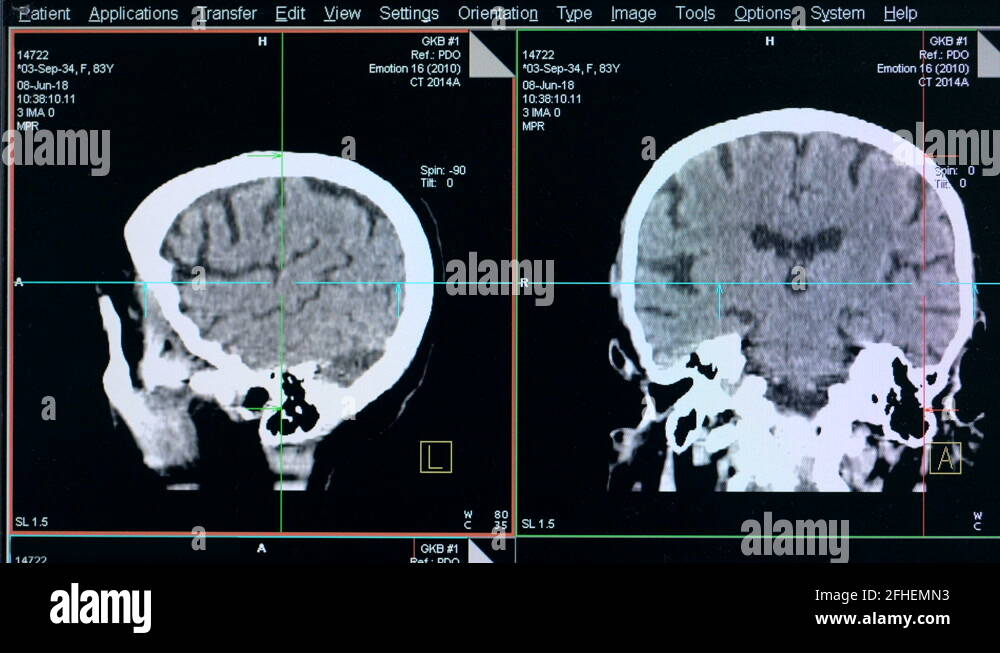 Head scan machine Stock Videos & Footage - HD and 4K Video Clips - Alamy