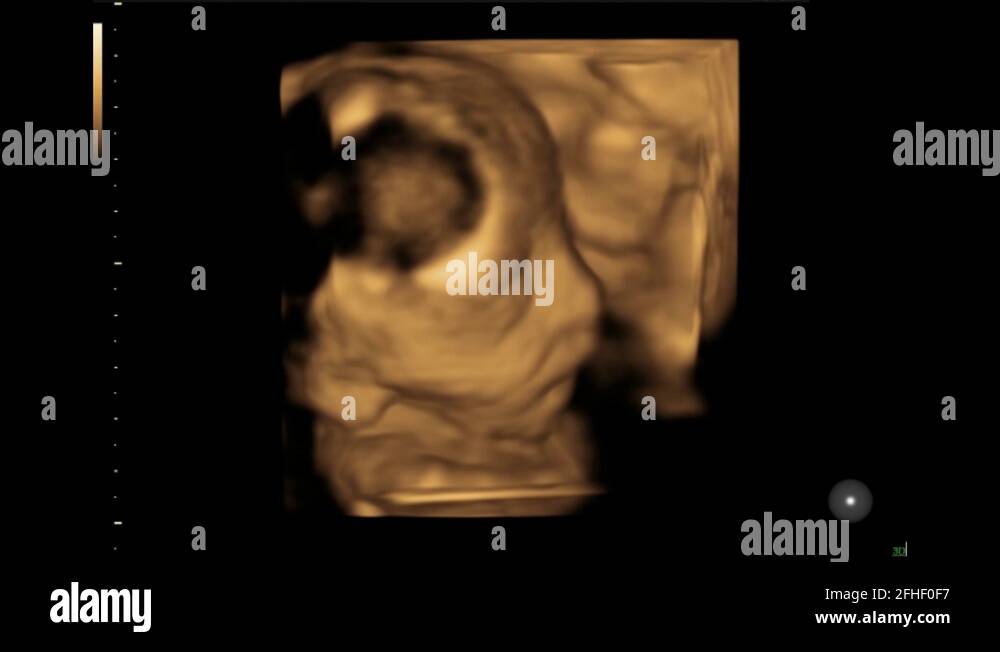 3d ultrasound embryo Stock Videos & Footage - HD and 4K Video Clips - Alamy