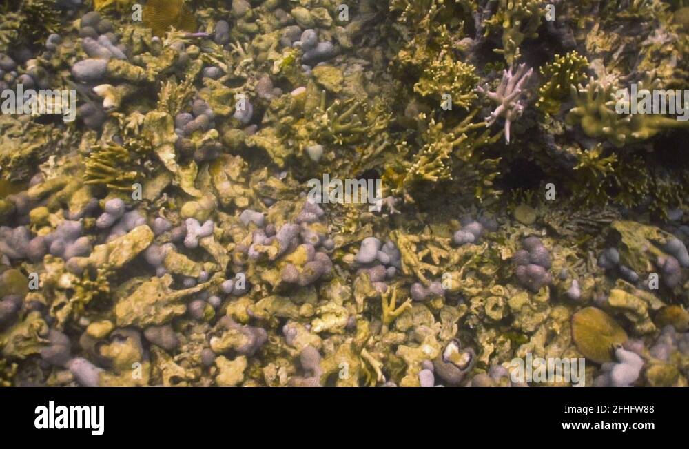 Shallow color of skin Stock Videos & Footage - HD and 4K Video Clips ...