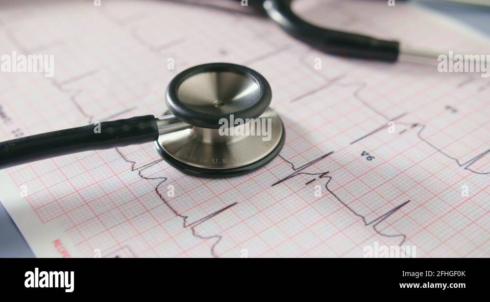 Electrocardiogram tracing paper Stock Videos & Footage - HD and 4K ...