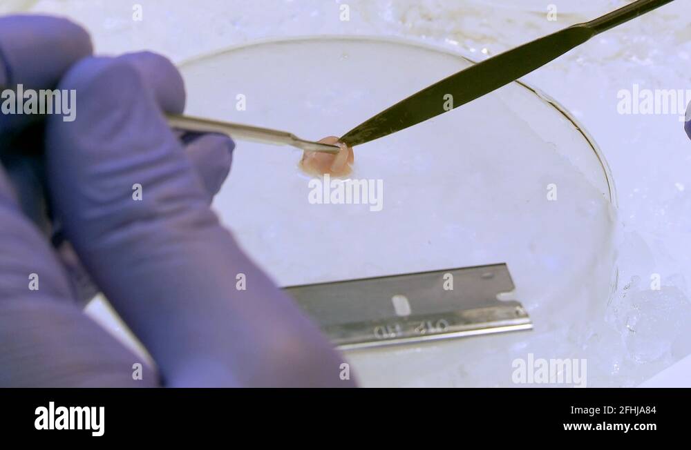 Forceps on glass Stock Videos & Footage - HD and 4K Video Clips - Alamy