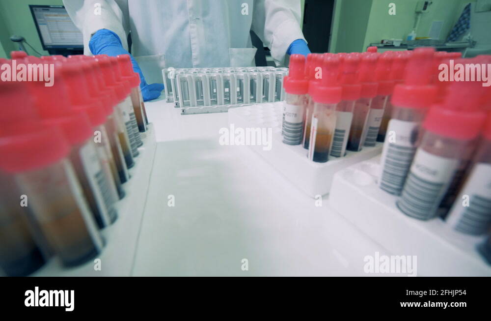 Blood probes in containers are being inserted into a medical tray Stock ...