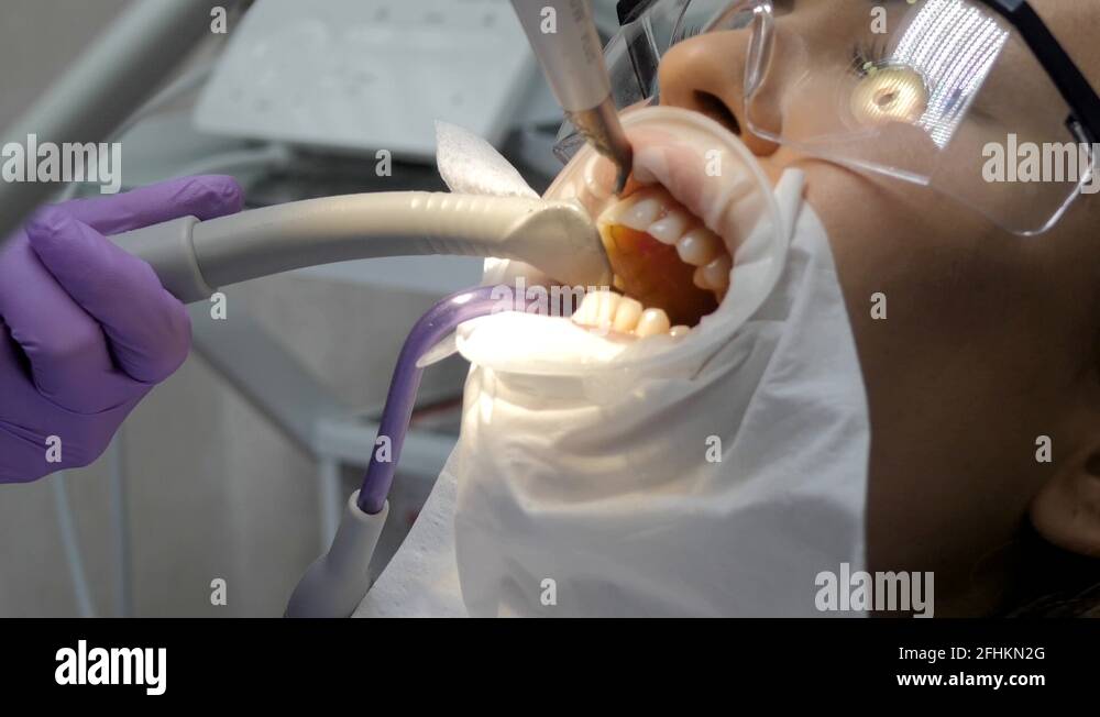 Women teeth Stock Videos & Footage - HD and 4K Video Clips - Alamy