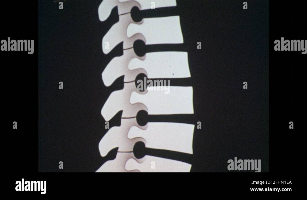 1960s: Illustration of spine. Animated cross-section of discs between ...