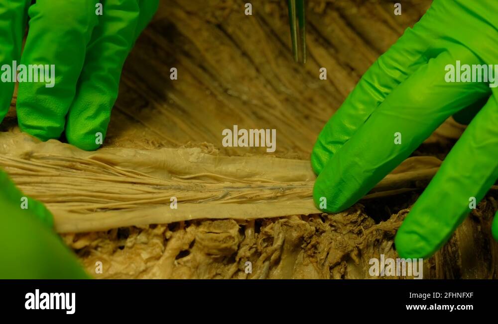 Medical dissection human body Stock Videos & Footage - HD and 4K Video ...