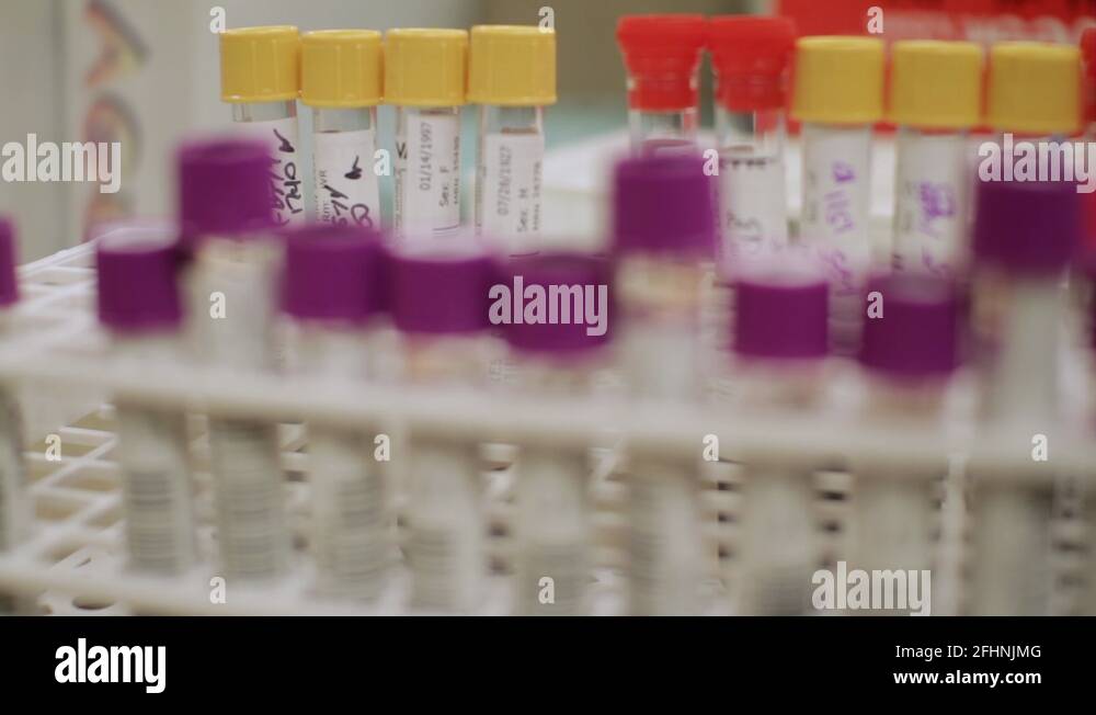 Medical lab and microscope Stock Videos & Footage - HD and 4K Video ...