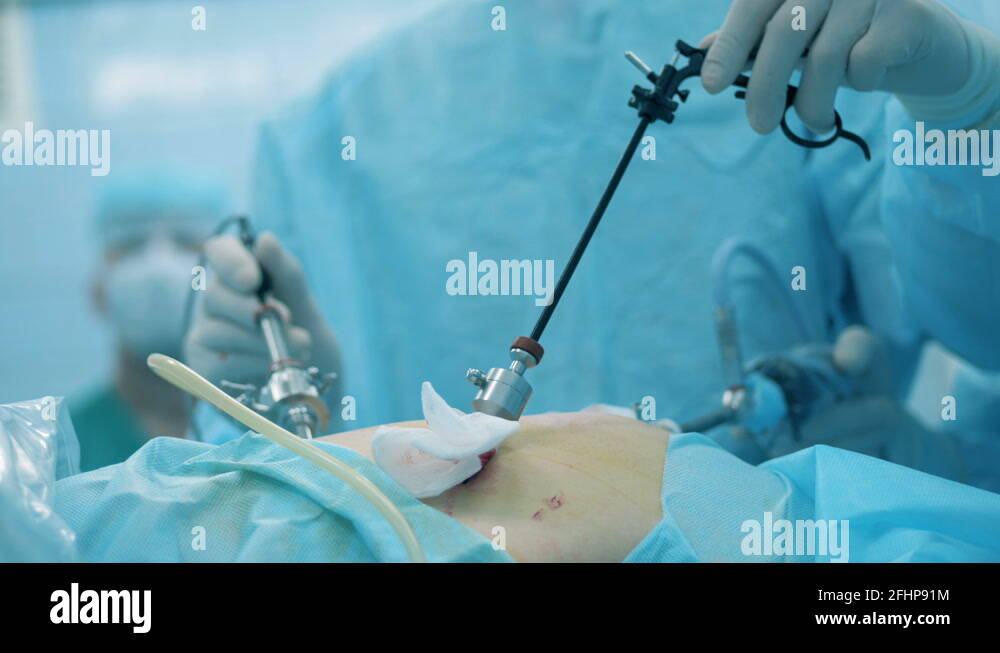 Abdominal cavity undergoing laparoscopic surgery in a close up Stock ...