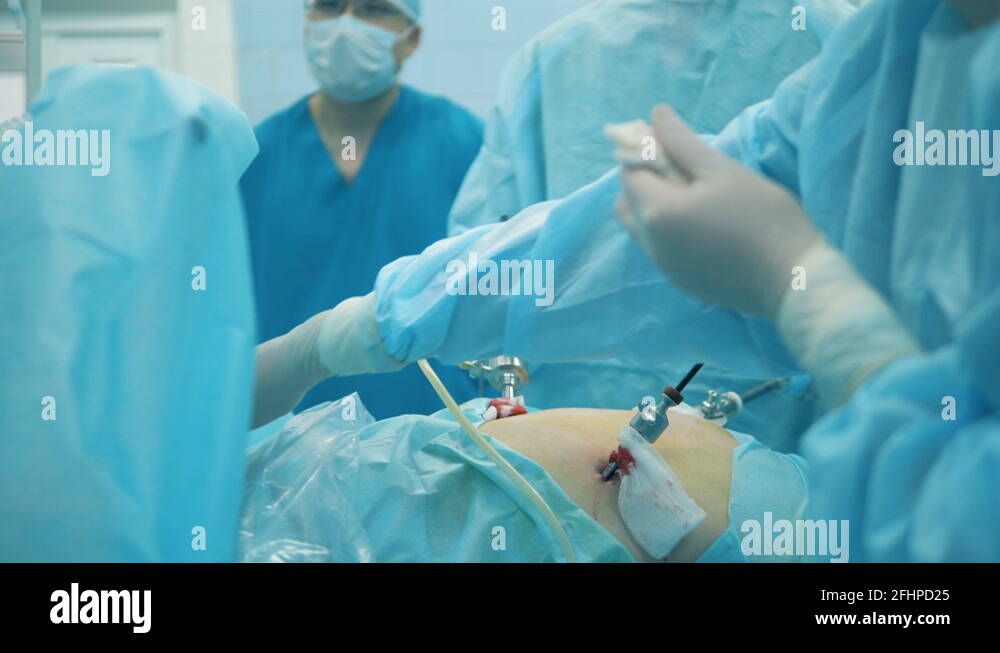 Appendicitis laparoscopy Stock Videos & Footage - HD and 4K Video Clips ...