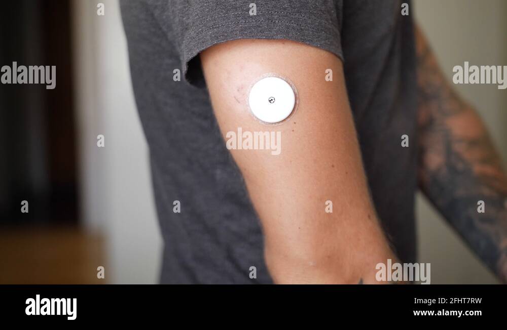 Diabetes sensor arm Stock Videos & Footage - HD and 4K Video Clips - Alamy