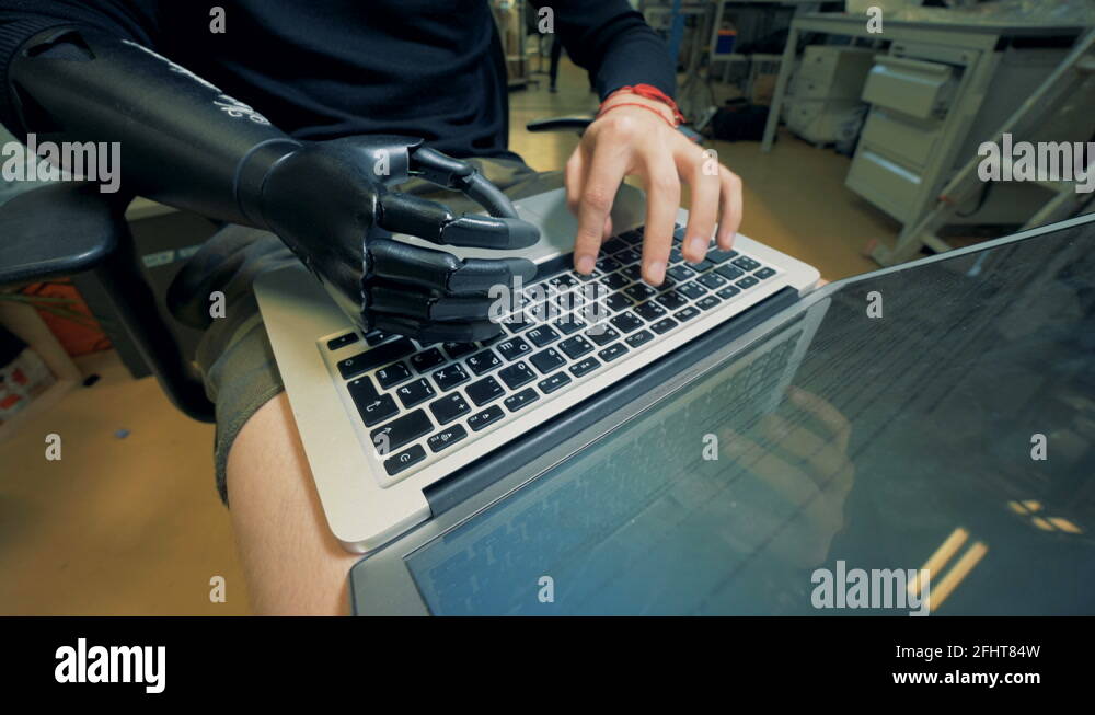 Working man with one robotic hand types on a laptop on his knees. 4K ...