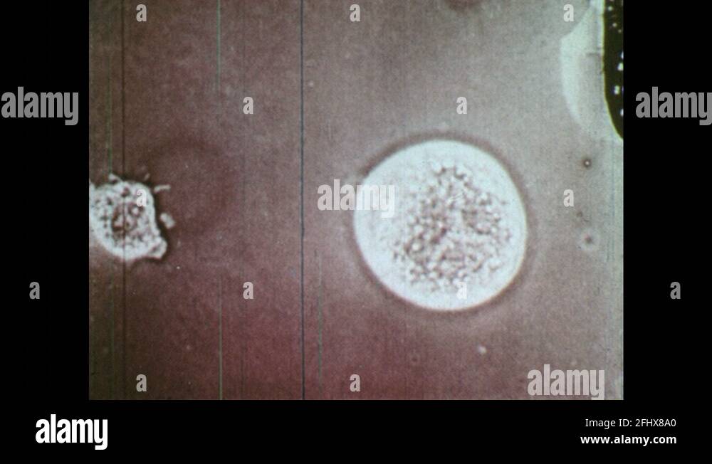 1960s: Magnified cancer cells spread and reproduce on microscope slide ...
