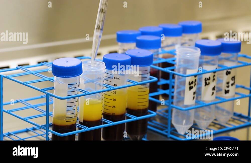 Blood plasma platelets Stock Videos & Footage - HD and 4K Video Clips ...