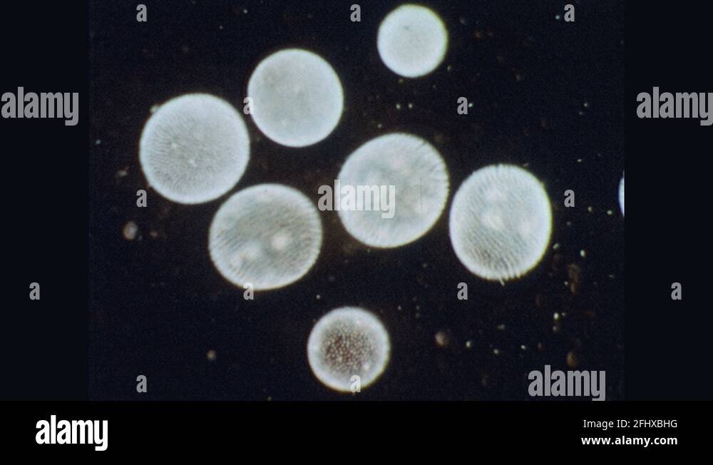 1960s: UNITED STATES: volvox cells under microscope. Magnified sphere ...