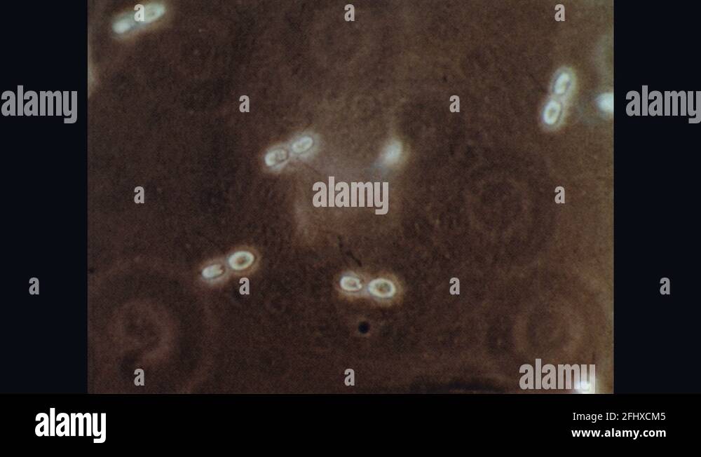 1960s: UNITED STATES: single cell organism under microscope. Protozoan ...