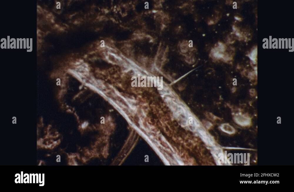 Feeder roots Stock Videos & Footage - HD and 4K Video Clips - Alamy