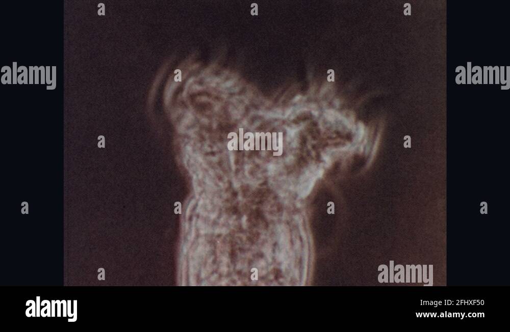 1960s: UNITED STATES: rotifer animal and beating cilia. Rotary movement ...