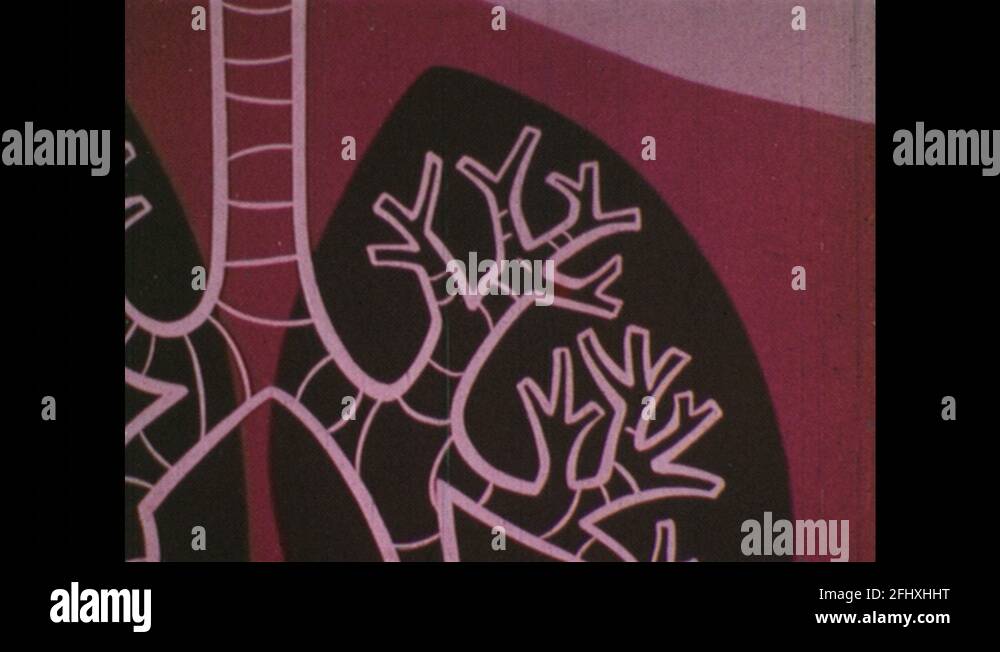 1960s: Illustrated picture of man with cross-section lungs. Red circle ...