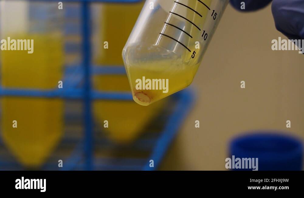 Exposing the Platelets in the bottom of a Sterile Conical Tube ...