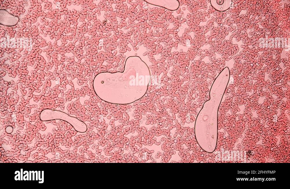 Sepsis microscope Stock Videos & Footage - HD and 4K Video Clips - Alamy