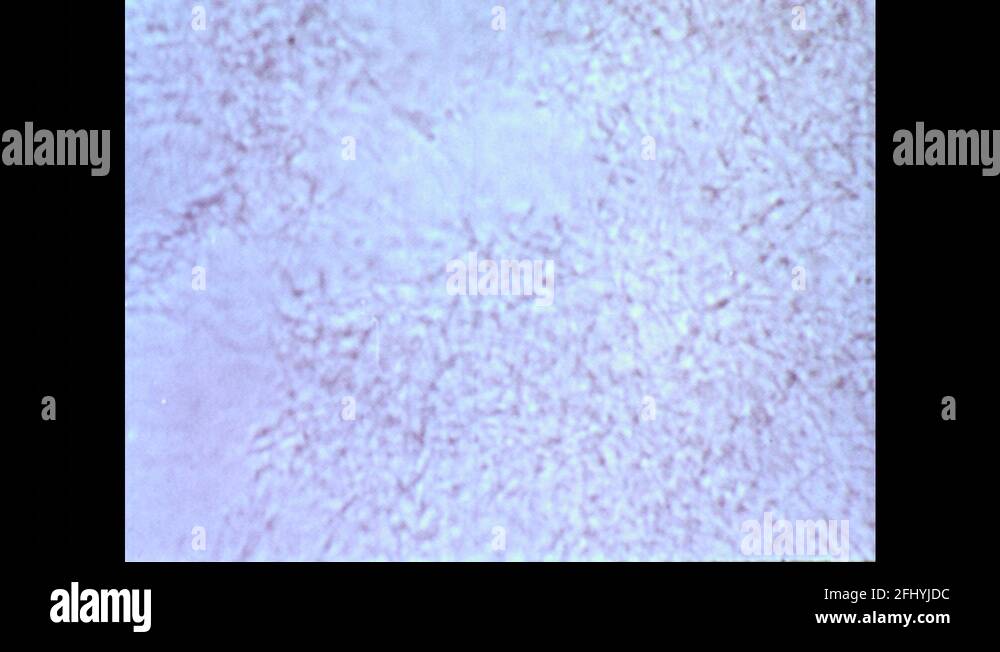 1960s: Magnified bacteria wiggle on microscope slide. Petri dish with ...