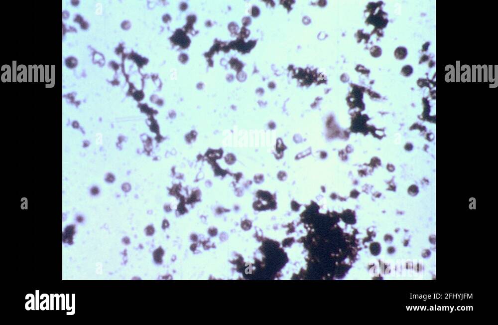 1960s: Microscopic protozoa swim on microscope slide. Reproducing ...