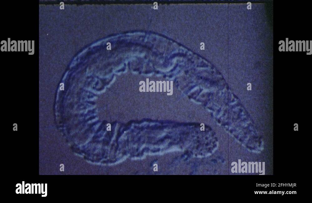 Parasitic worm microscope Stock Videos & Footage - HD and 4K Video ...