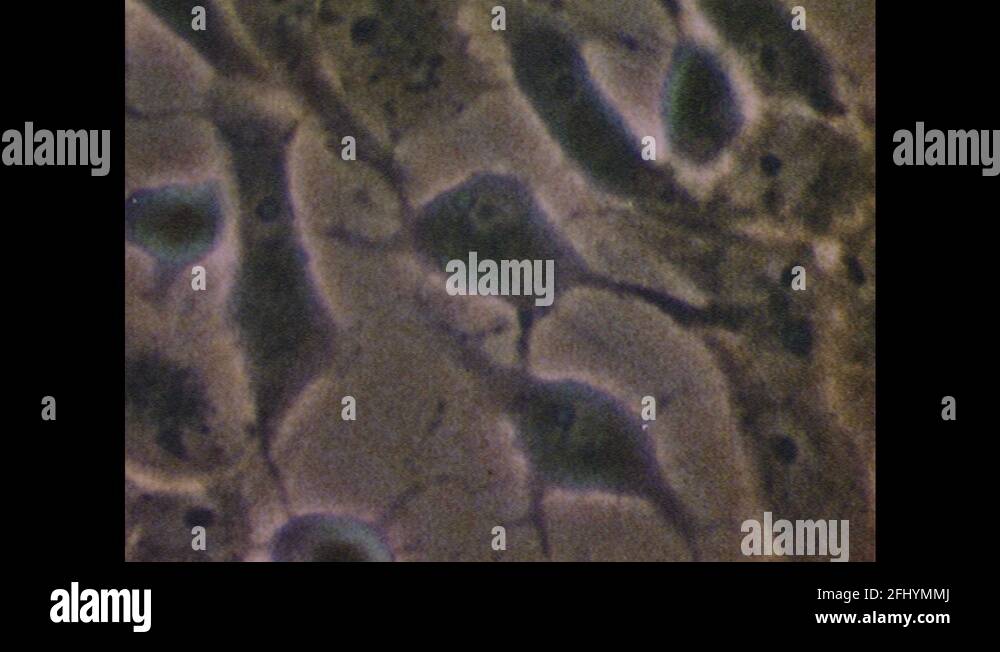 Viruses cells Stock Videos & Footage - HD and 4K Video Clips - Alamy