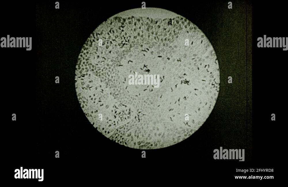 Tb treatment Stock Videos & Footage - HD and 4K Video Clips - Alamy