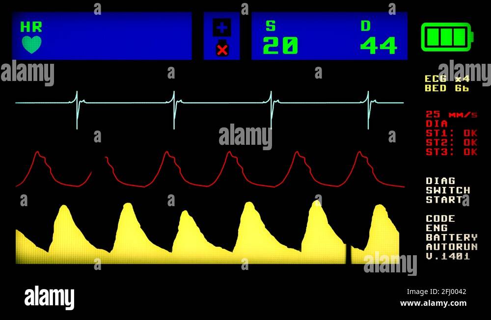 Ecg screen display Stock Videos & Footage - HD and 4K Video Clips - Alamy