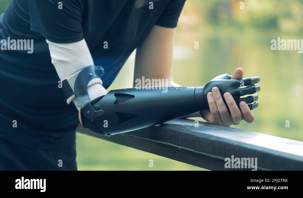 Modern artificial arm on a disabled person. Futuristic concept. 4K ...